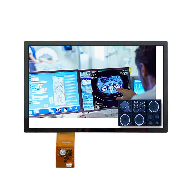 TFT Technology ST7789V3 Drive Ic LCD TFT Display with 216.96 W *135.6 H ...